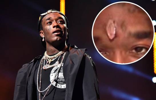 Rapero se incrusta un diamante de 24 millones de dólares en la frente ...